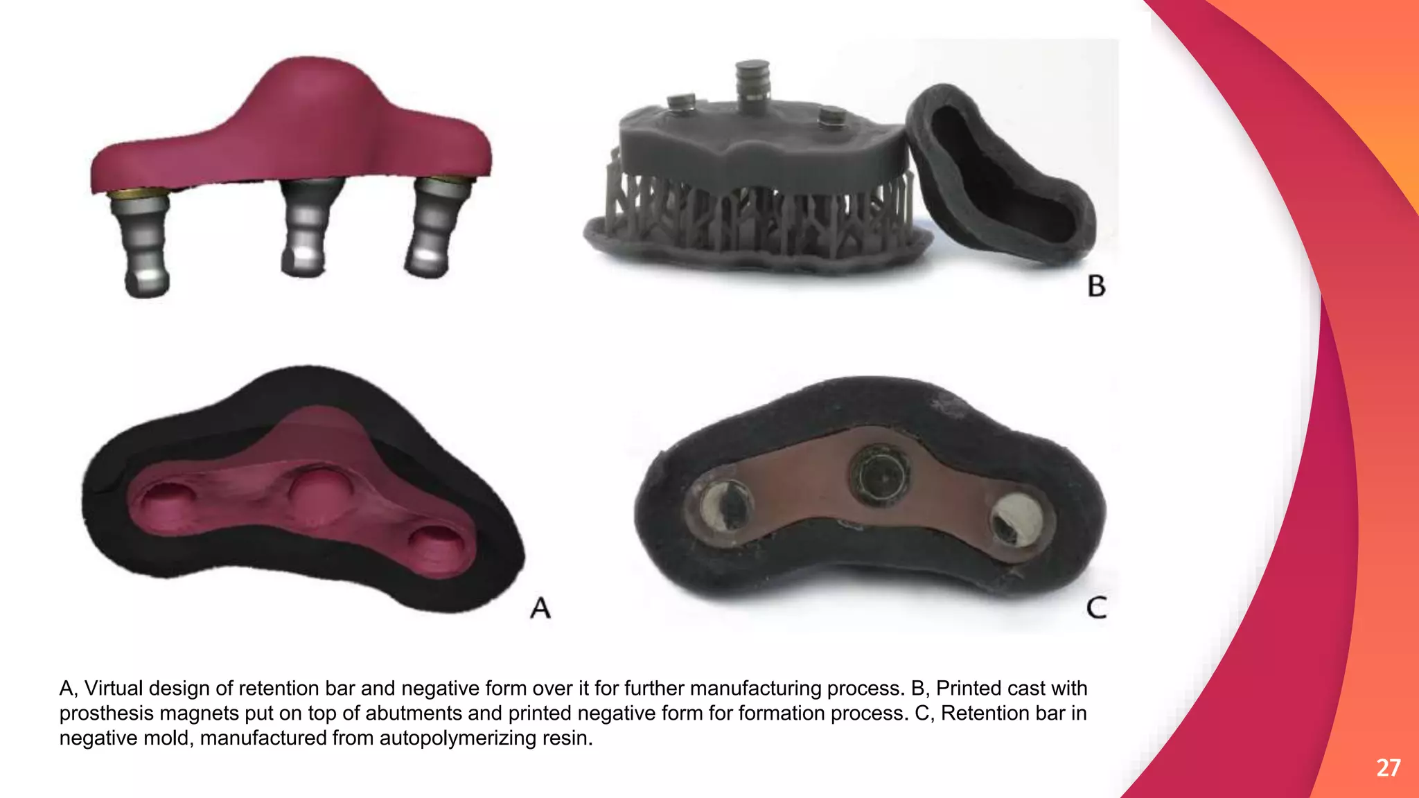 Auricular prosthesis.pptx