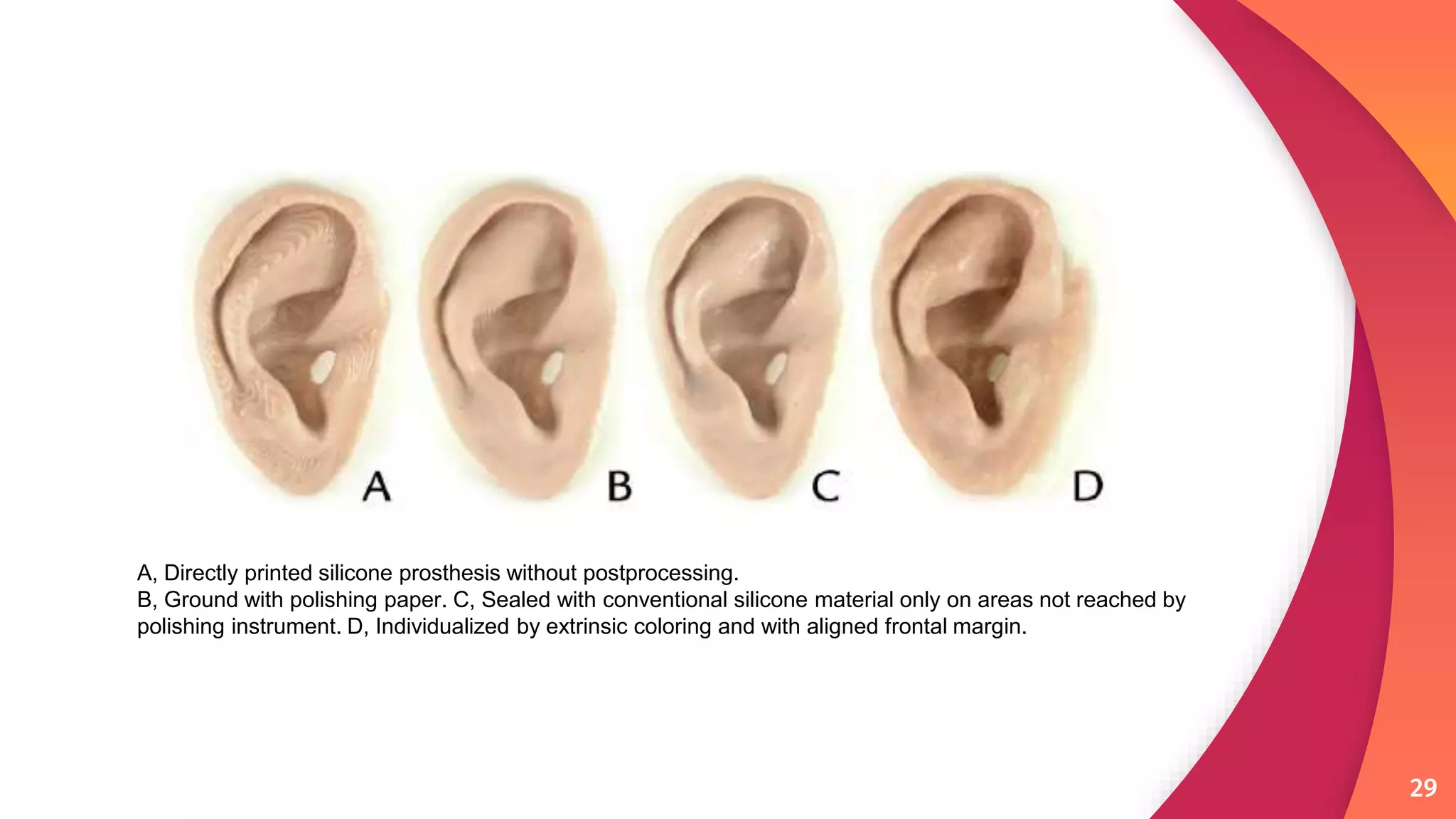 Auricular prosthesis.pptx