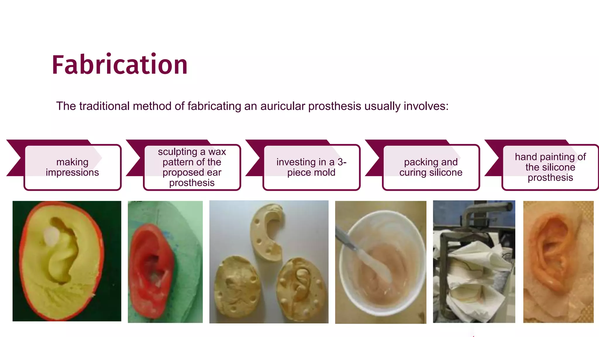 Auricular prosthesis.pptx