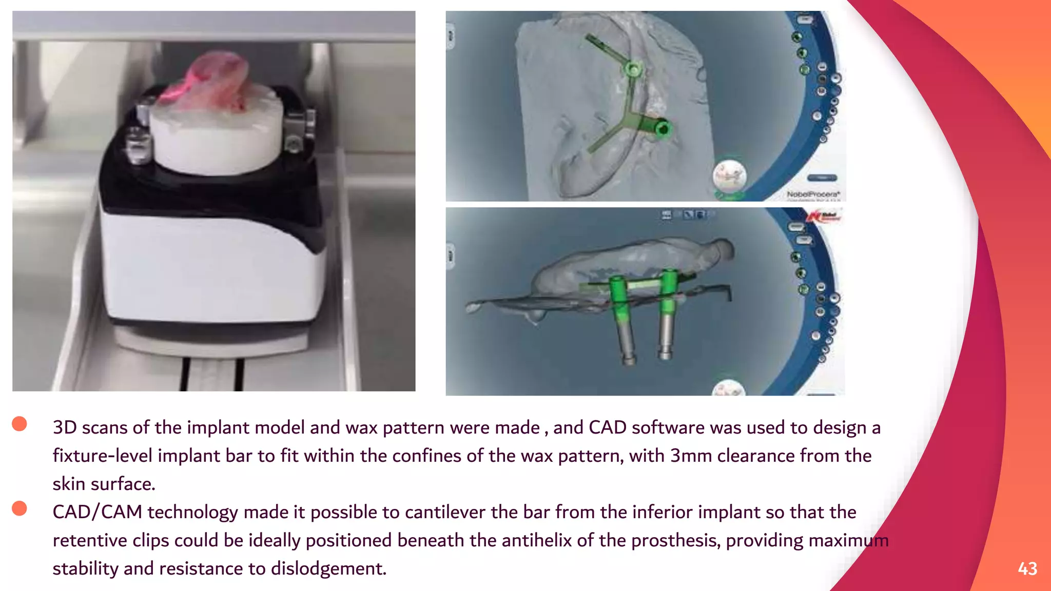 Auricular prosthesis.pptx