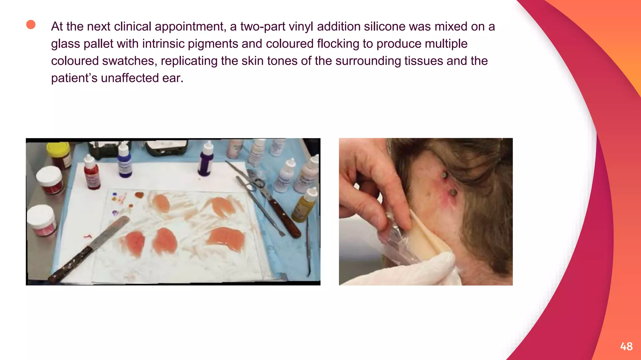 Auricular prosthesis.pptx