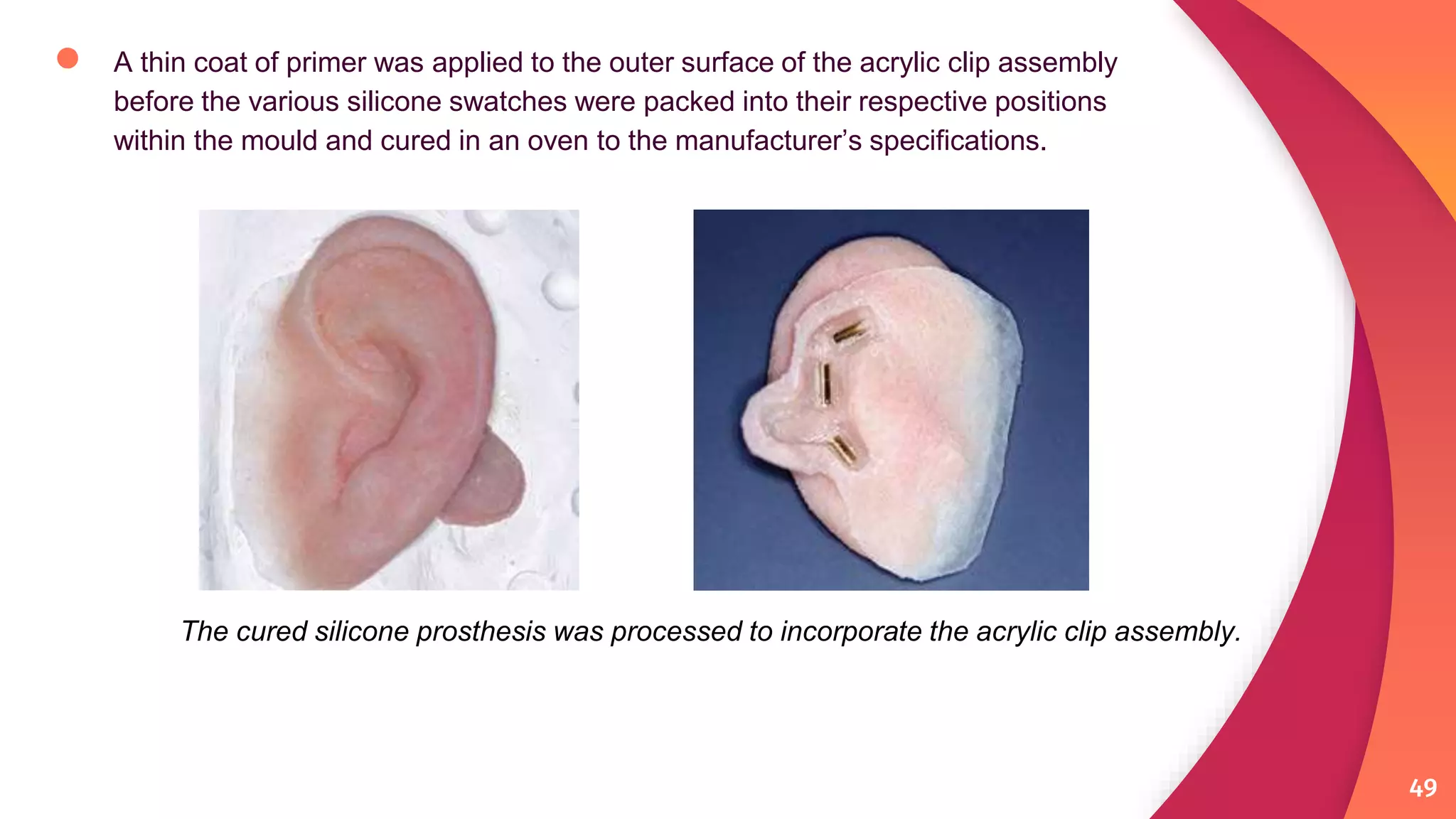 Auricular prosthesis.pptx
