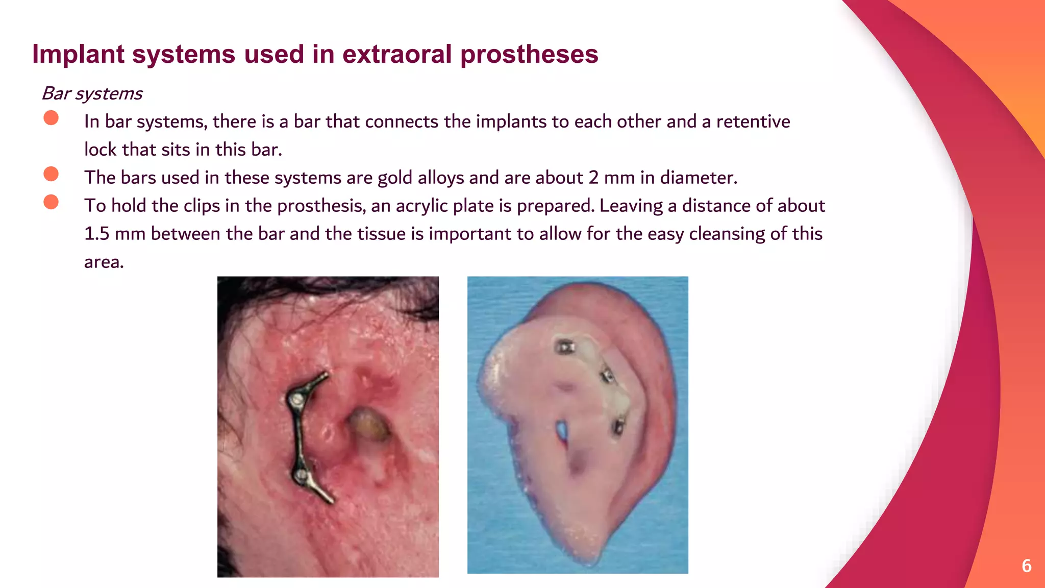 Auricular prosthesis.pptx