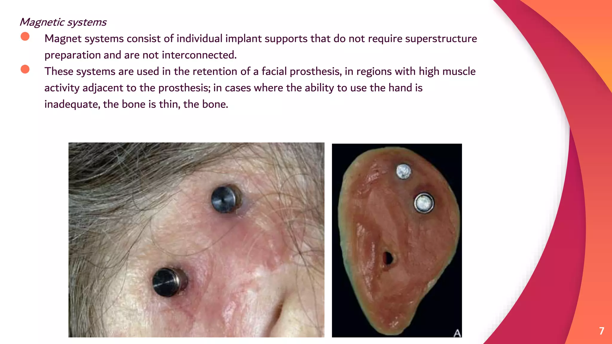 Auricular prosthesis.pptx
