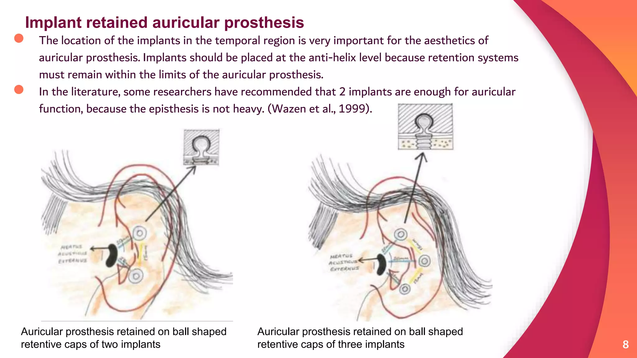 Auricular prosthesis.pptx