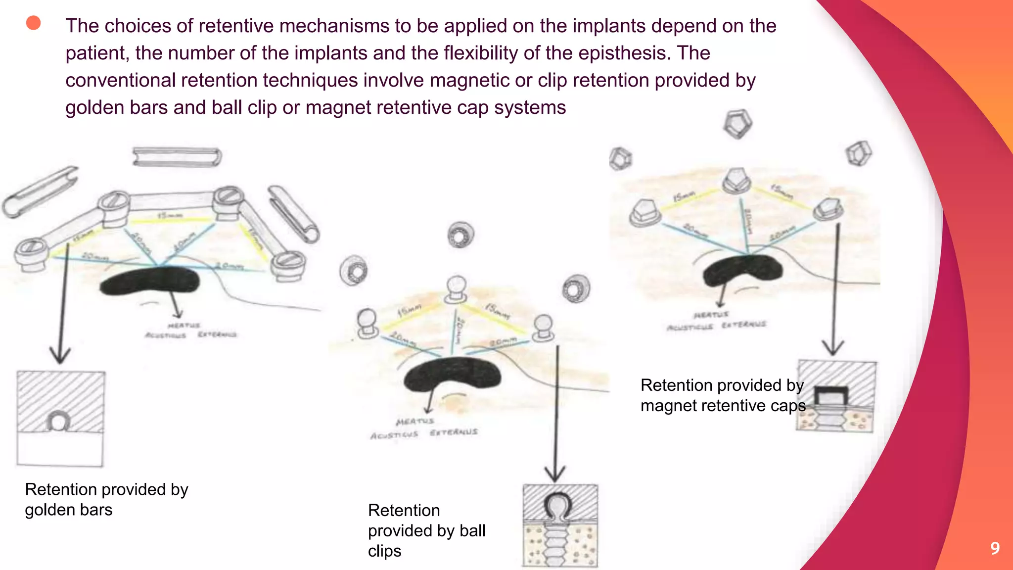 Auricular prosthesis.pptx