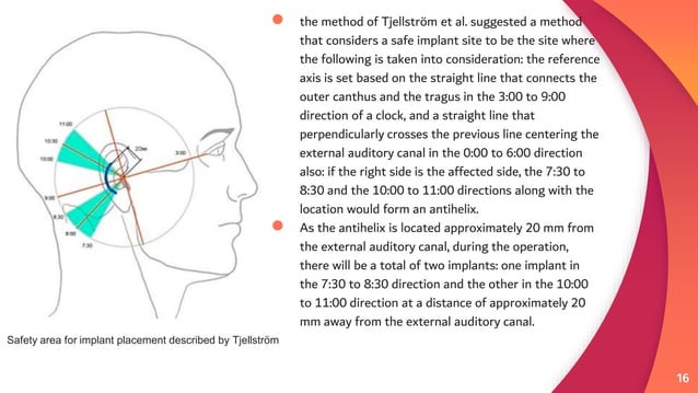 Auricular prosthesis.pptx