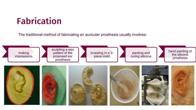 Auricular prosthesis.pptx