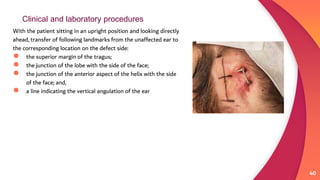 Auricular prosthesis.pptx