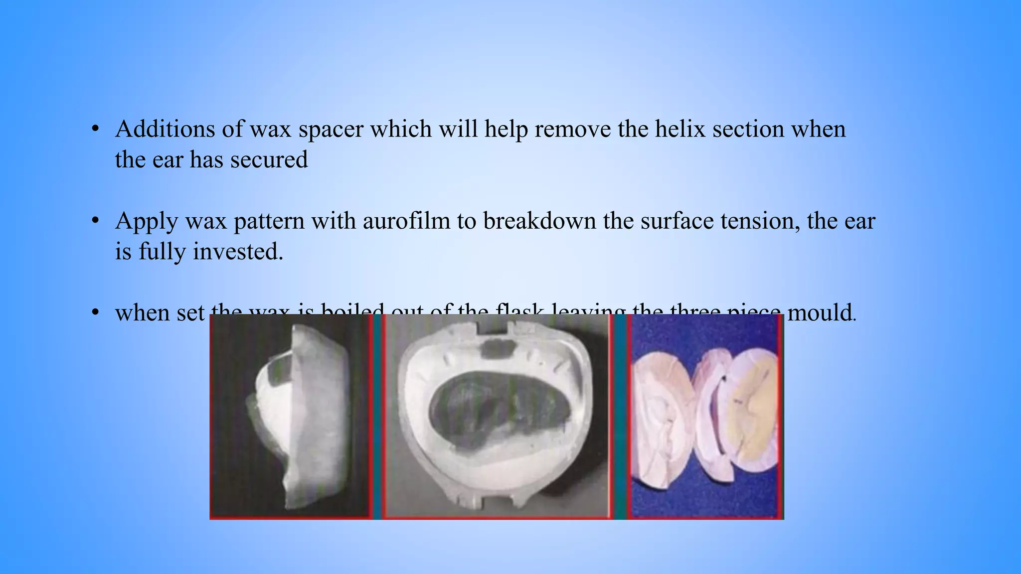 AURICULAR PROSTHESIS (SEMI 3).pptx