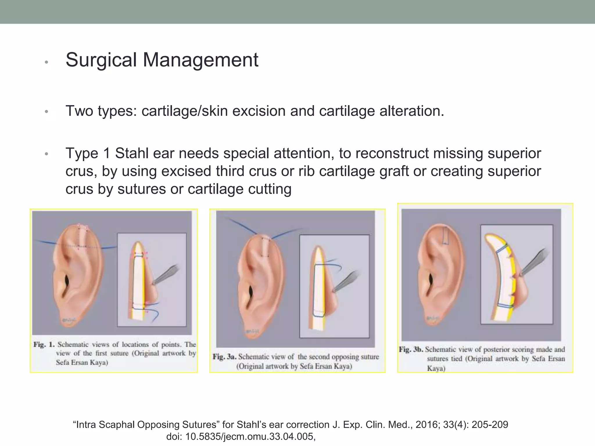 AURICULAR Reconstruction 1.pptx