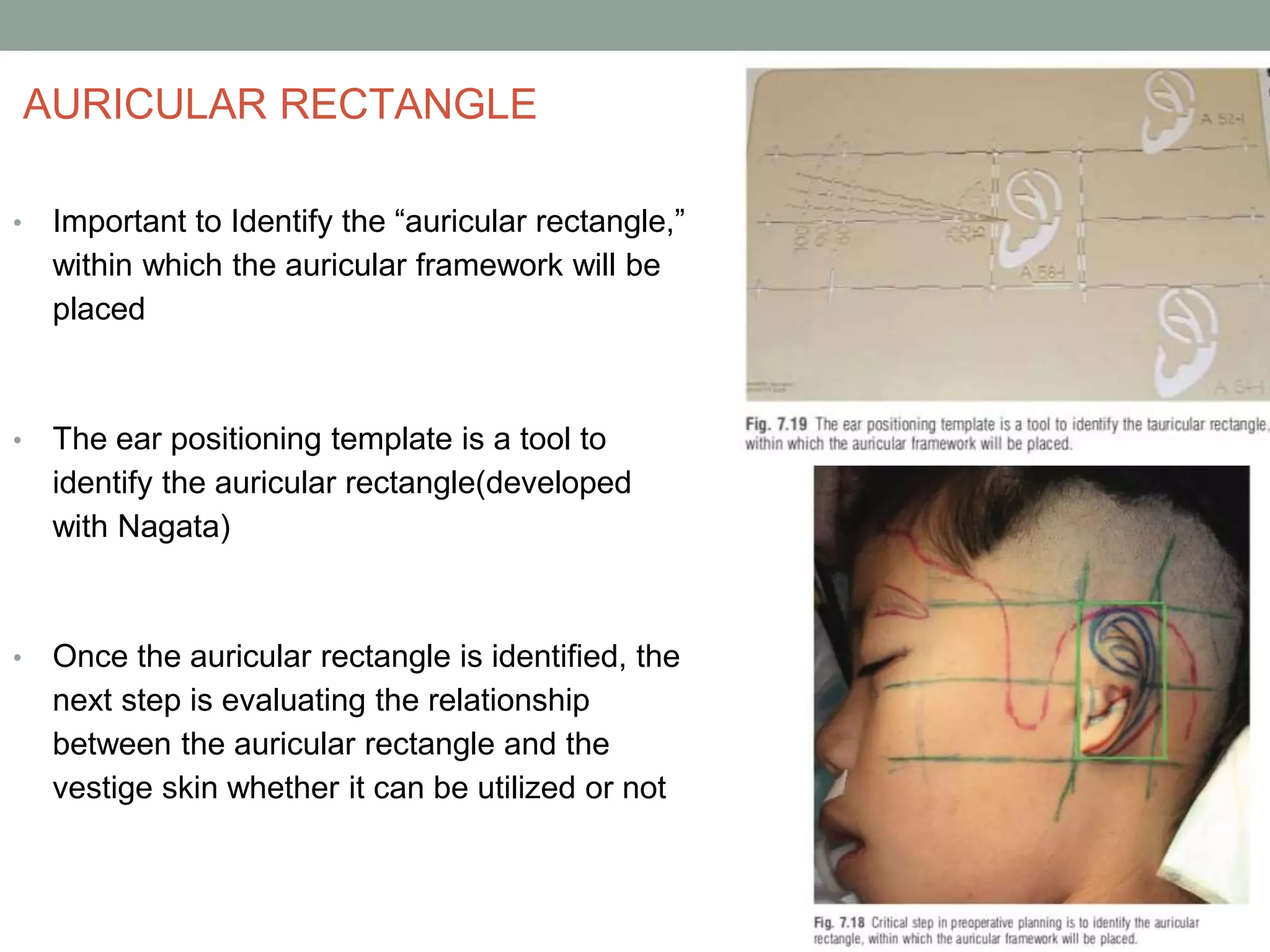 AURICULAR Reconstruction 1.pptx