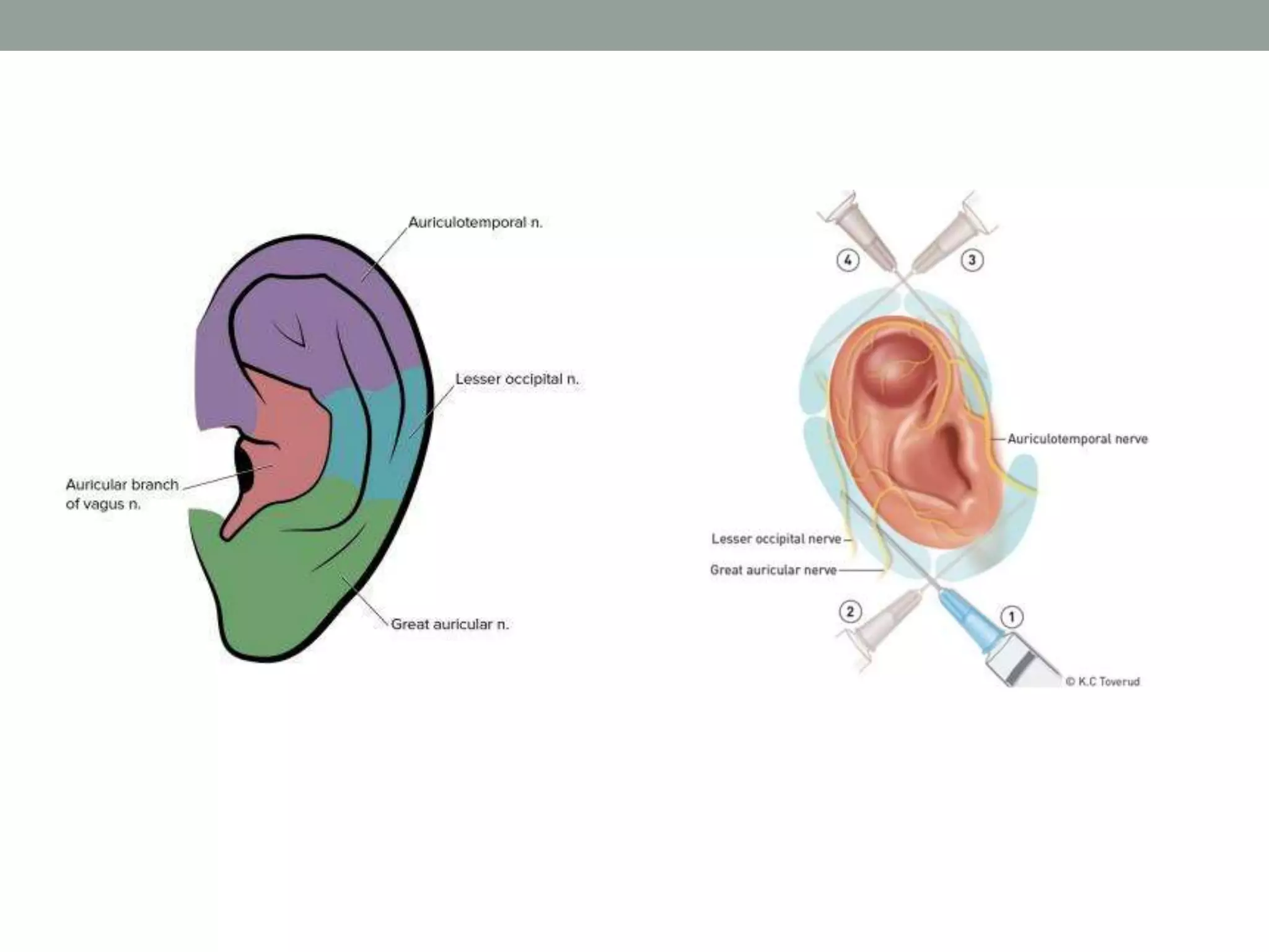 AURICULAR Reconstruction 1.pptx