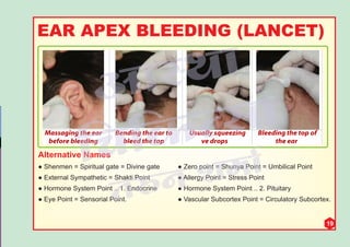 Auricular Therapy-1.pdf