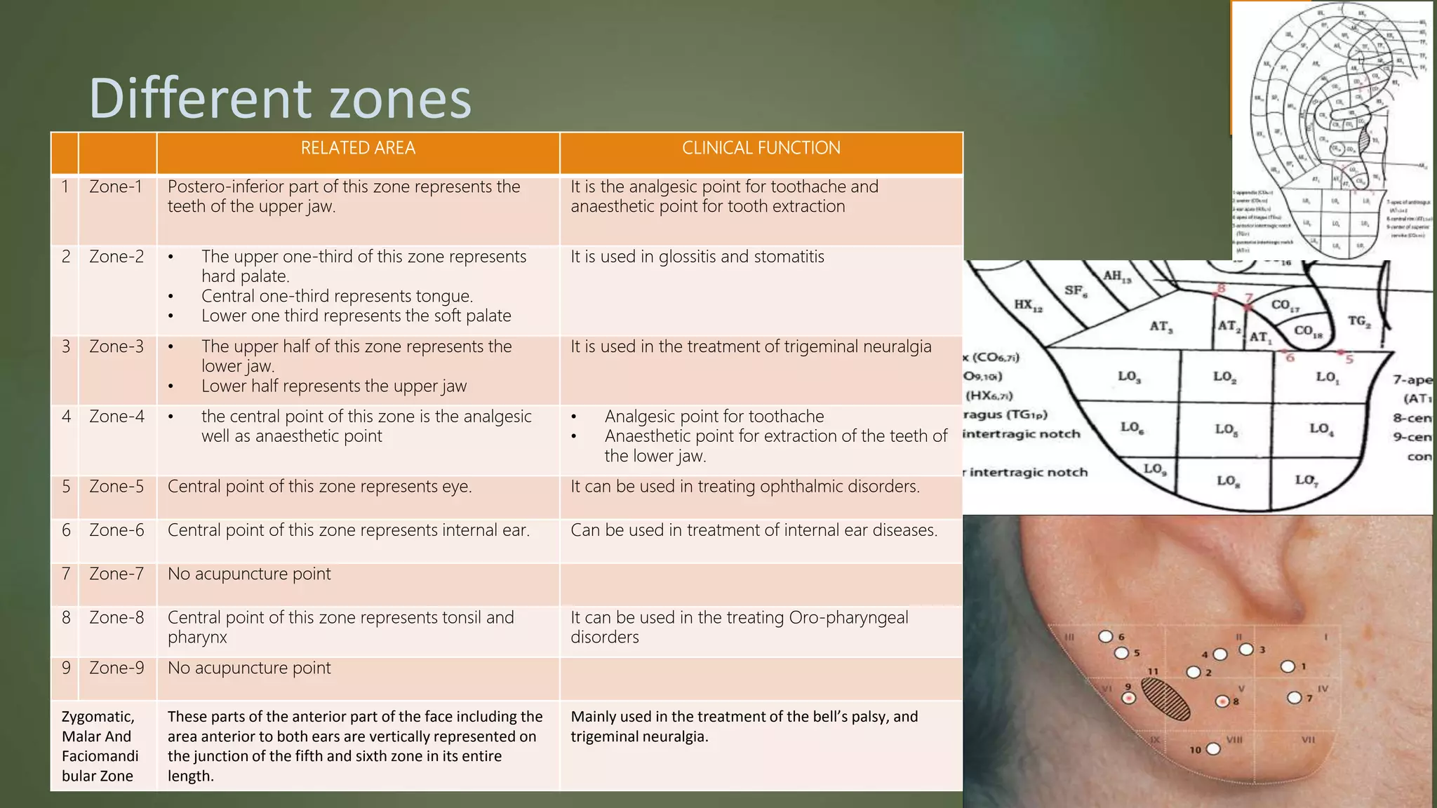 Auriculotherapy | PPTX