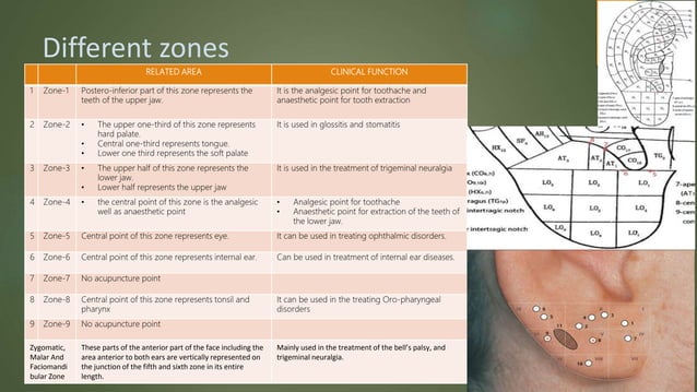 Auriculotherapy | PPTX | Ear, Nose and Throat Conditions | Diseases and ...