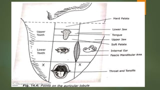 Auriculotherapy | PPTX