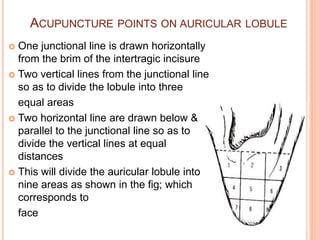 aucupuncture Auriculotherapy.ppt