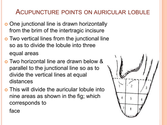 aucupuncture Auriculotherapy.ppt