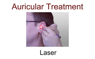 Auriculotherapy Overview | PPT