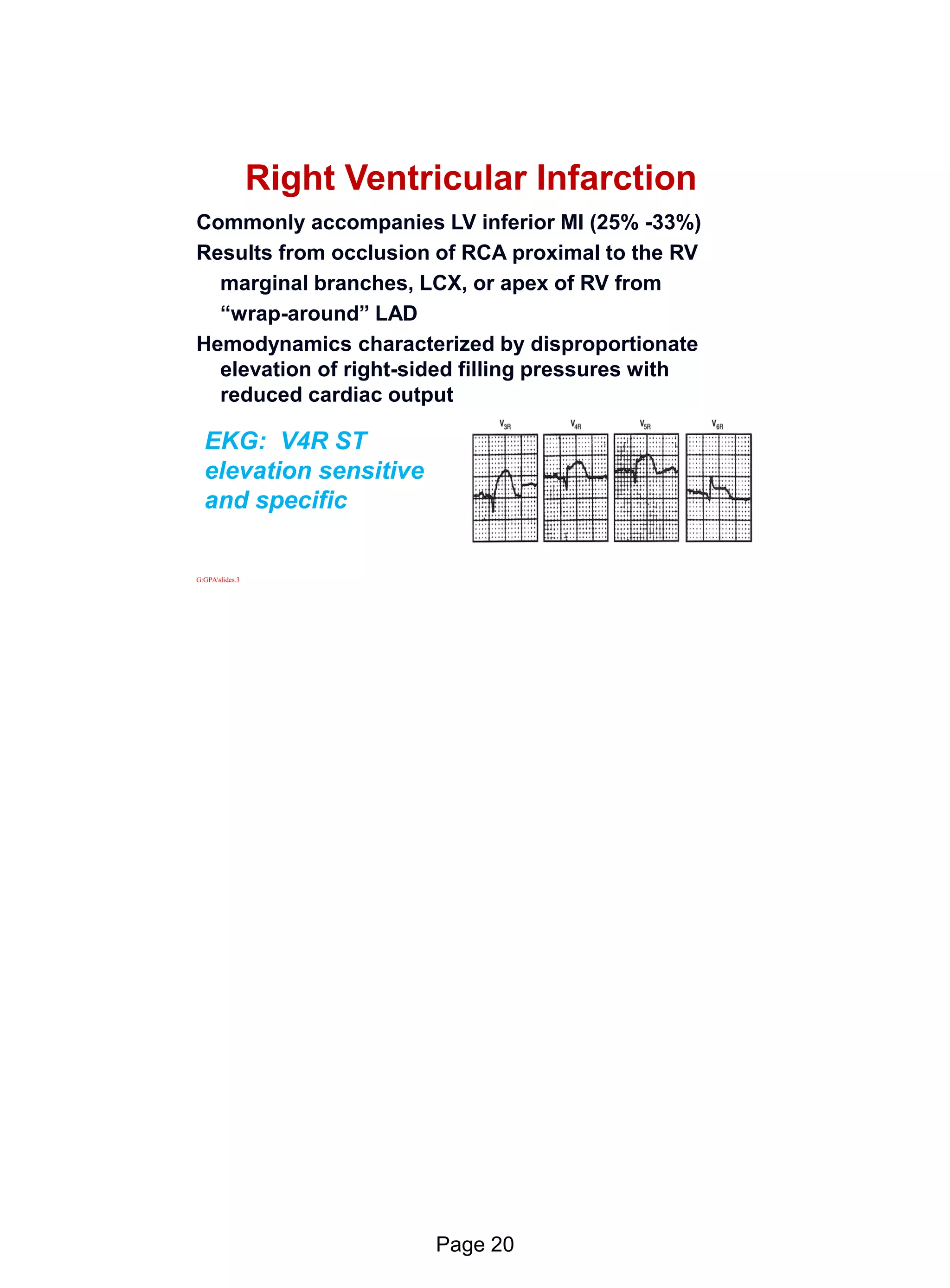 Echo in ischaemic heart disease and Myocardial infarction | PDF