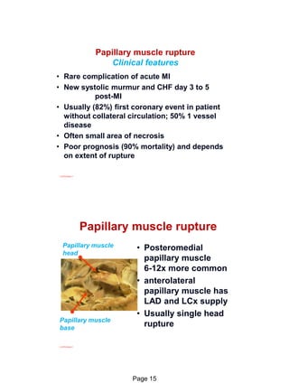 Echo in ischaemic heart disease and Myocardial infarction | PDF