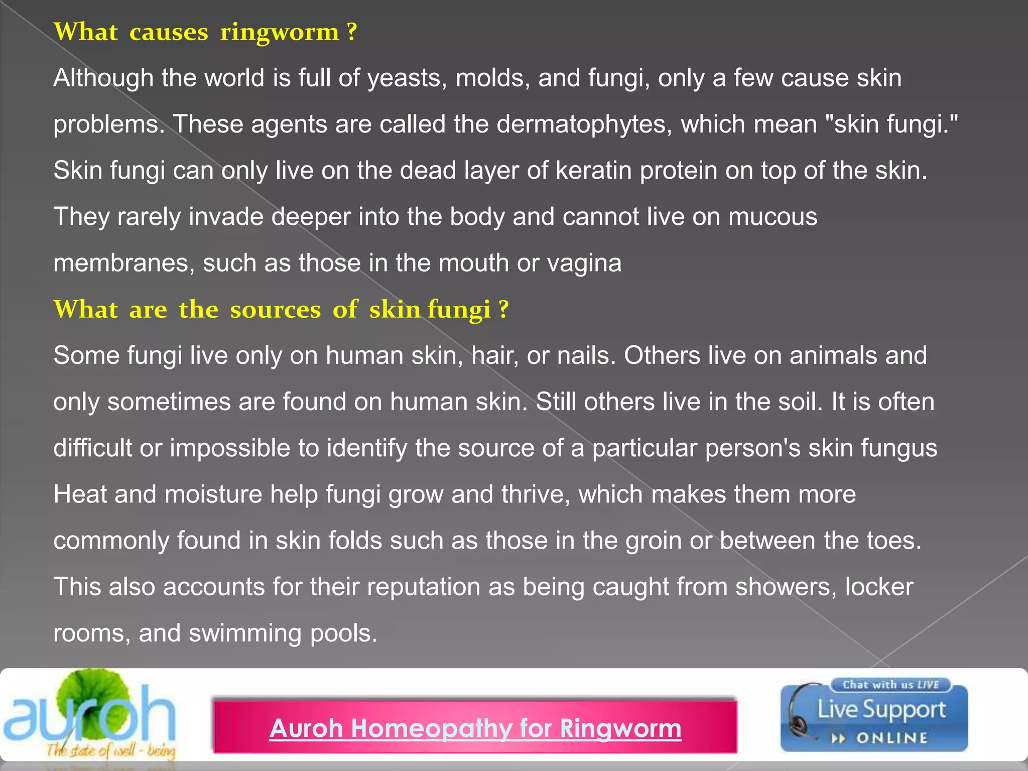 Auroh ringworm homeopathic treatment | PPTX