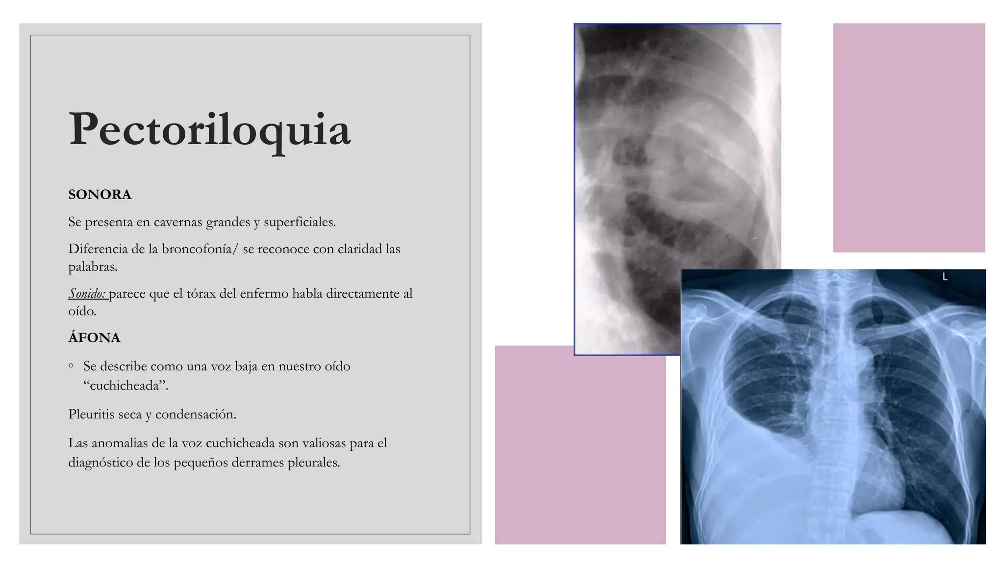 Auscultación.pptx