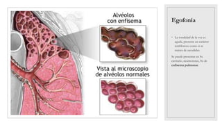 Auscultación.pptx