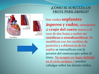 Auscultación cardíaca por el Dr. Efraín Salvioli | PPTX