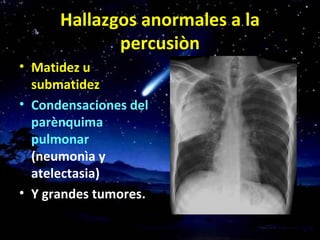 Auscultaciòn pulmonar | PPT