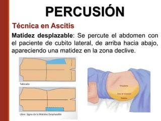 Auscultación y Percusión Abdominal | PPTX