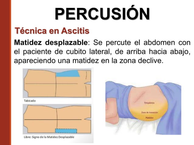 Auscultación y Percusión Abdominal