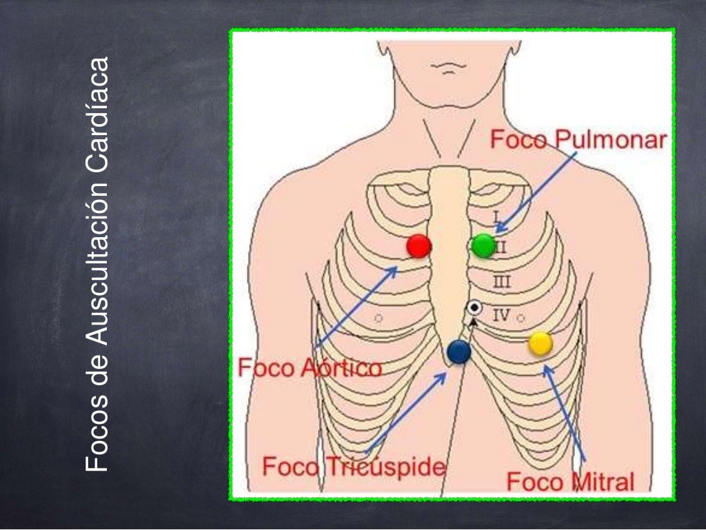 Auscultacion cardíaca en 4 pasos