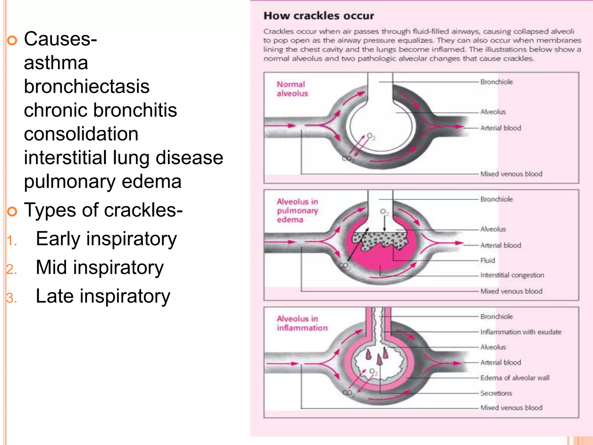 Auscultation | PPTX