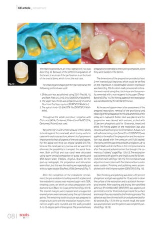 Eight-year follow-up of successful intentional replantation | PDF