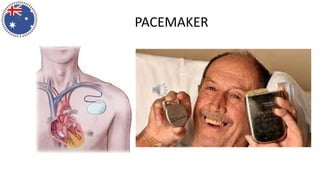 Australian inventions | PPTX