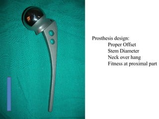 Austin Moore’S Prosthesis Surgical Technique | PPT