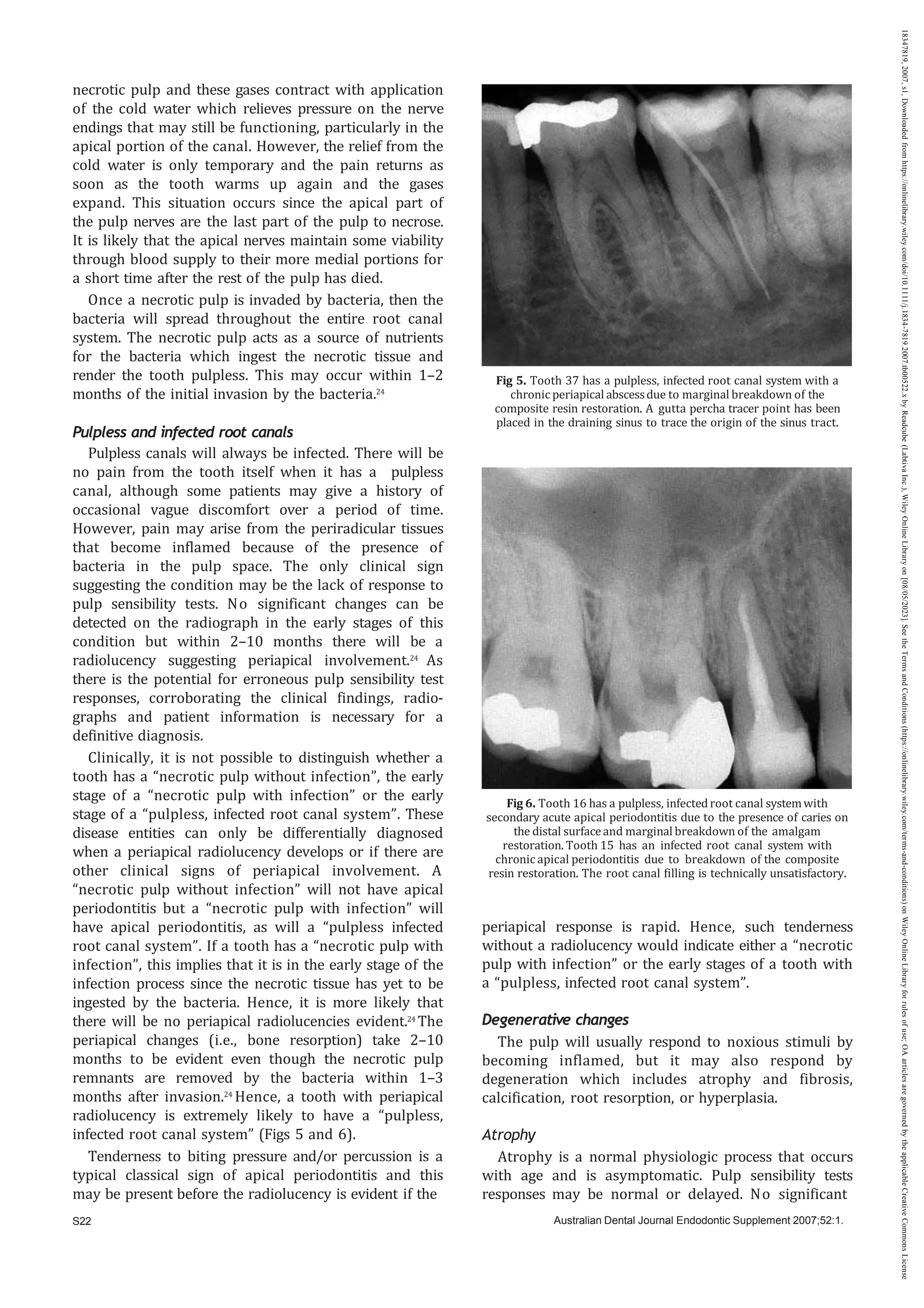 Australian Dental Journal - 2008 - Abbott - A clinical classification ...