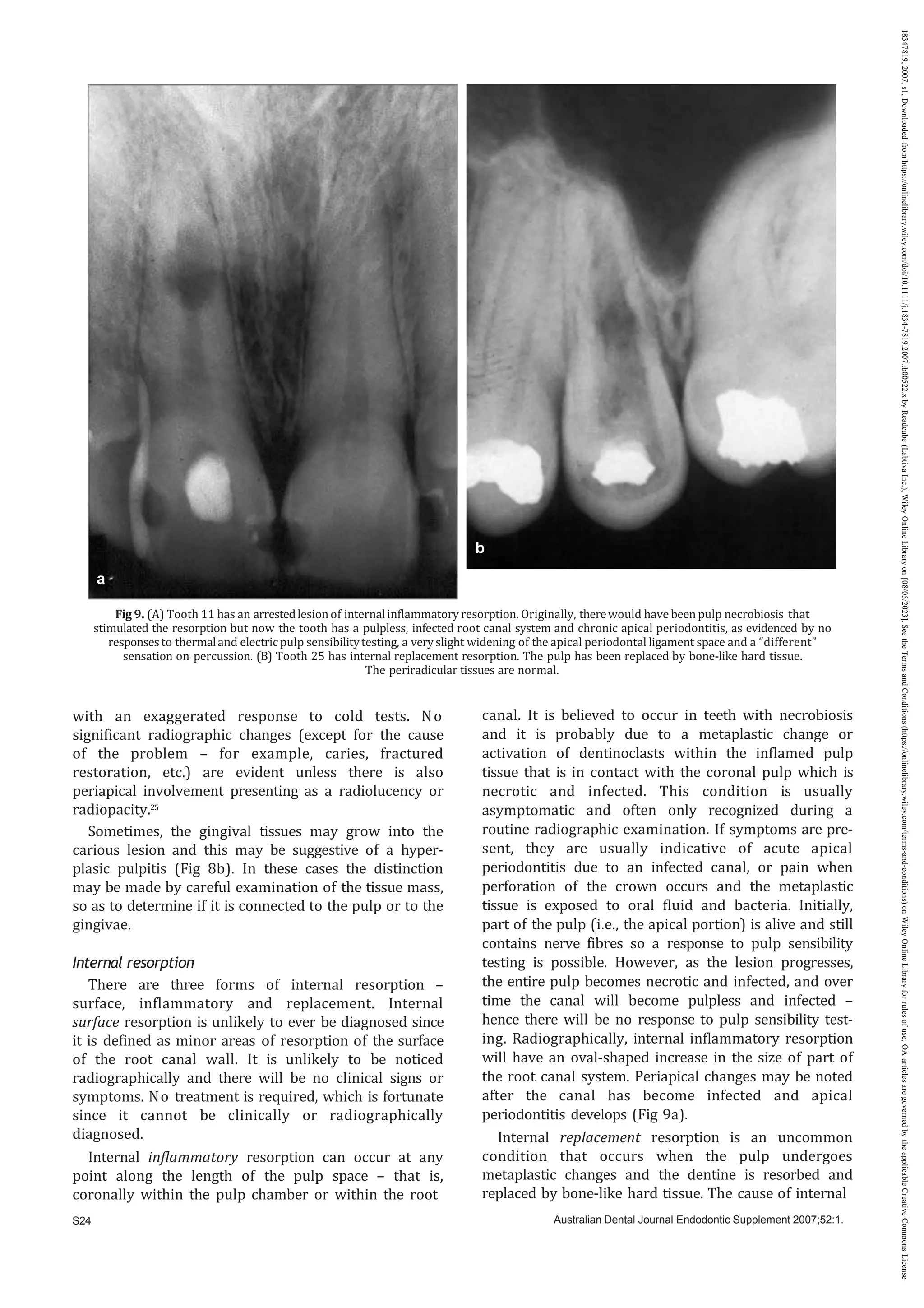 Australian Dental Journal - 2008 - Abbott - A clinical classification ...