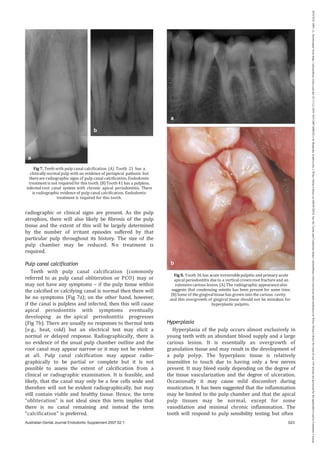 Australian Dental Journal - 2008 - Abbott - A clinical classification ...