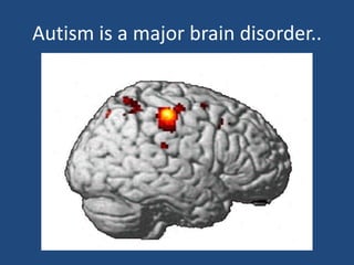 Autism | PPTX