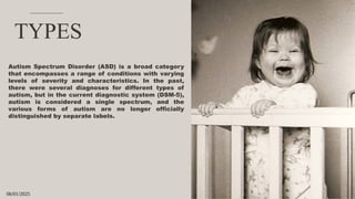 Autism spectrum disorder and its classification, causes, sign and ...