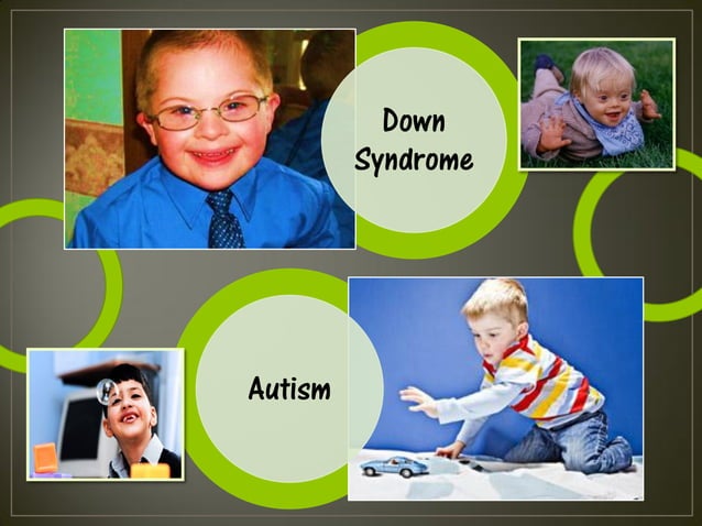 Autism and down sydrome in children | PPT