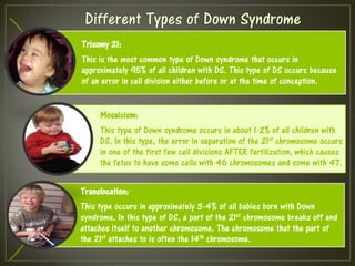 Autism and down sydrome in children | PDF