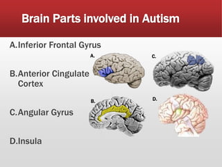 Autism and the Brain | PPTX