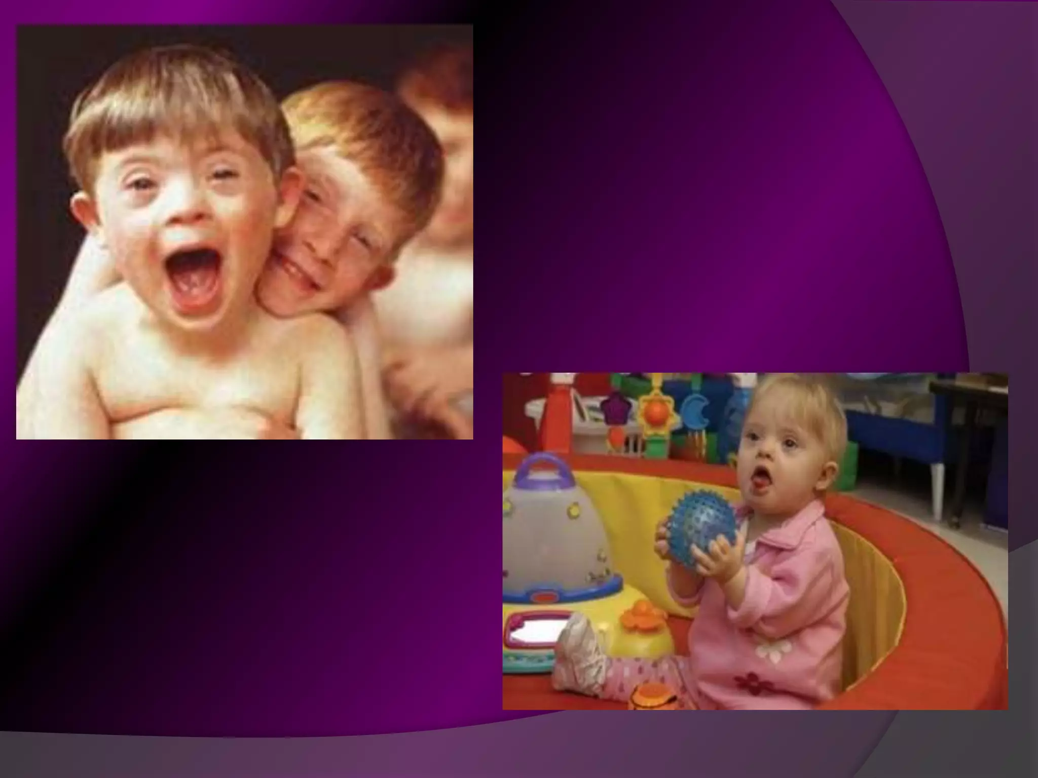 Autismo y sindrome de down | PPTX | Reproductive Health | Diseases and Conditions