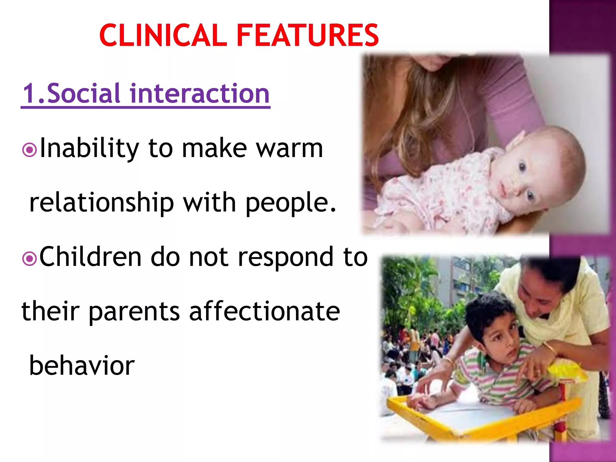 AUTISM ppt | PPTX