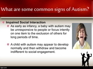 Autism report- SPED (James A. Permale BSSE-III) PNU-M | PPT