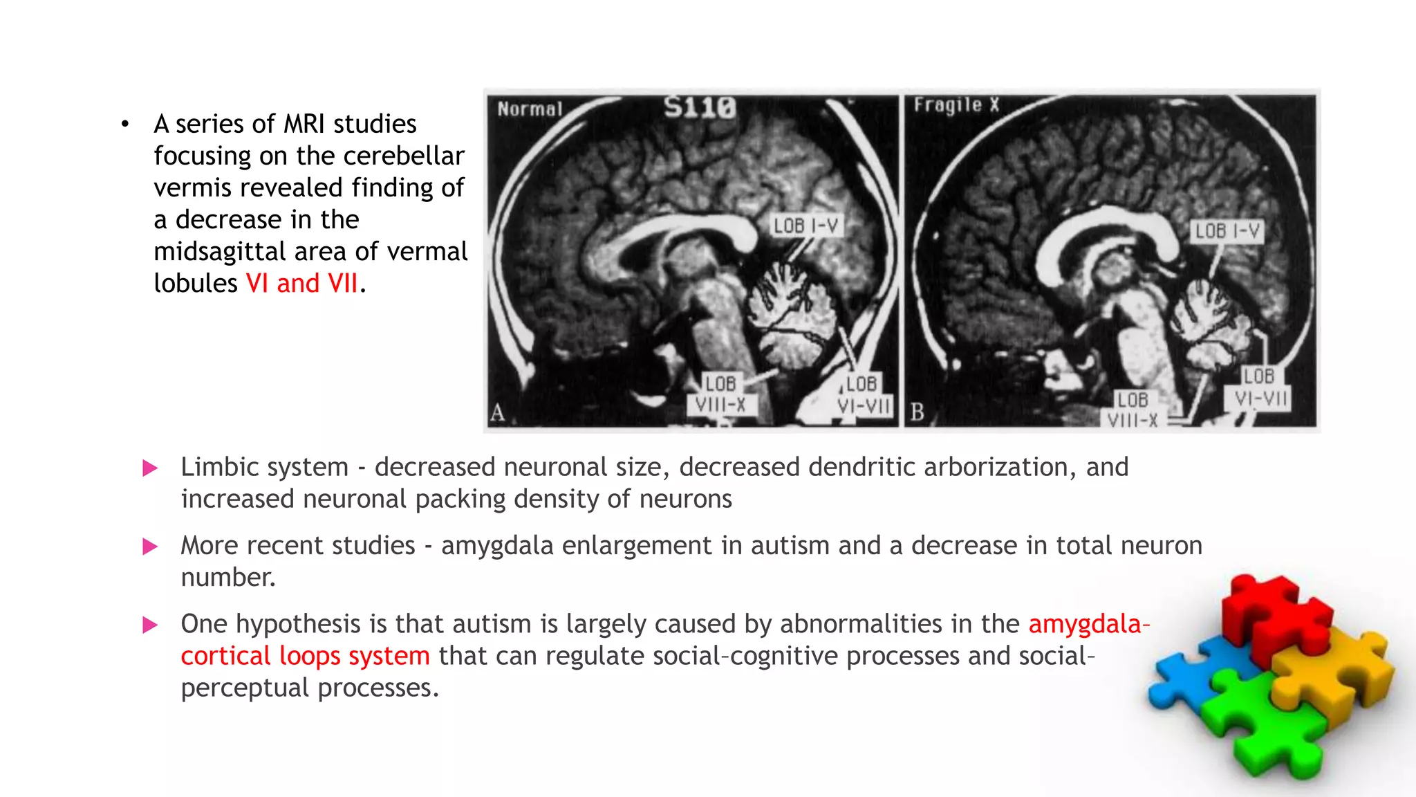 Autism spectrum disorder | PPTX